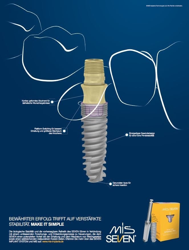 MIS Implants Technologies GmbH – ZWP online – das Nachrichtenportal für die Dentalbranche