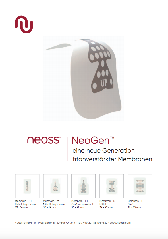 Neoss GmbH – ZWP online – das Nachrichtenportal für die Dentalbranche