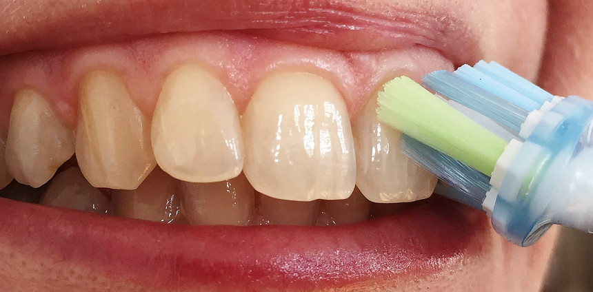 Gute Mundhygiene schützt allgemeine Gesundheit – ZWP online – das ...