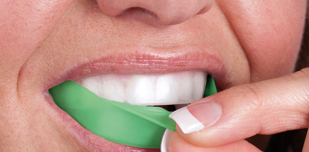 Bleaching to go: Einfach, professionell und vielfältig – ZWP online ...