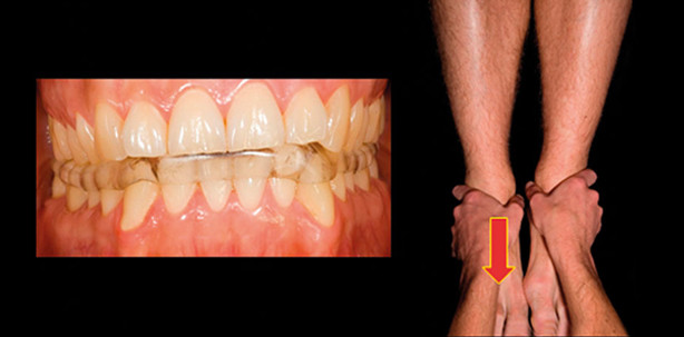 Die Bedeutung der Okklusion für Ätiologie und Therapie der CMD – ZWP ...