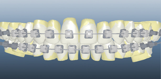 Eine neue Ära der digitalen KFO – ZWP online – das Nachrichtenportal ...