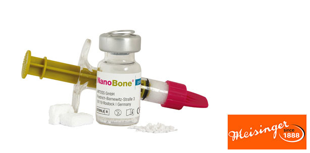 10 Jahre NanoBone® – eine Erfolgsgeschichte – ZWP online – das ...