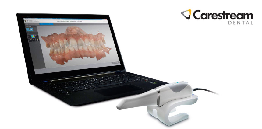 Automatische Modellsegmentierung mit CS Model+ – ZWP online – das ...