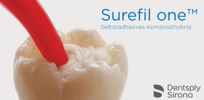 Surefil one: Neue Materialklasse Komposithybrid – ZWP online – das ...