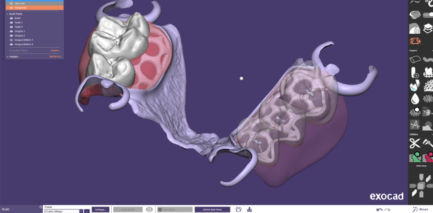 exocad: PartialCAD 3.1 Rijeka mit verbesserter Benutzerfreundlichkeit ...