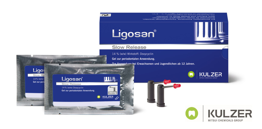 Ligosan® Slow Release – Ausdauernd gegen Parodontitis – ZWP online ...