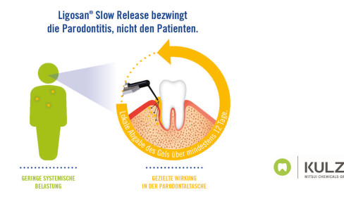 FAQs: Fragen und Antworten zur neuen PAR-Richtlinie – ZWP online – das ...