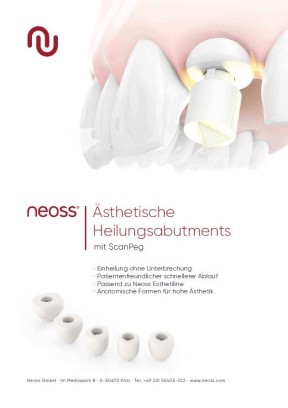 Neoss GmbH – ZWP online – das Nachrichtenportal für die Dentalbranche