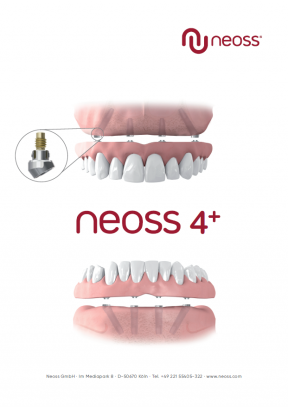 Neoss GmbH – ZWP online – das Nachrichtenportal für die Dentalbranche