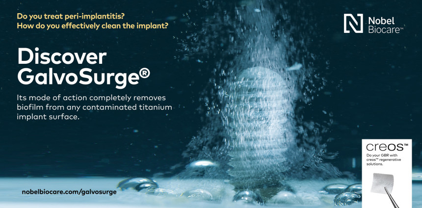 GalvoSurge® Dentalimplantat-Reinigungssystem mit neuer Technologie ...