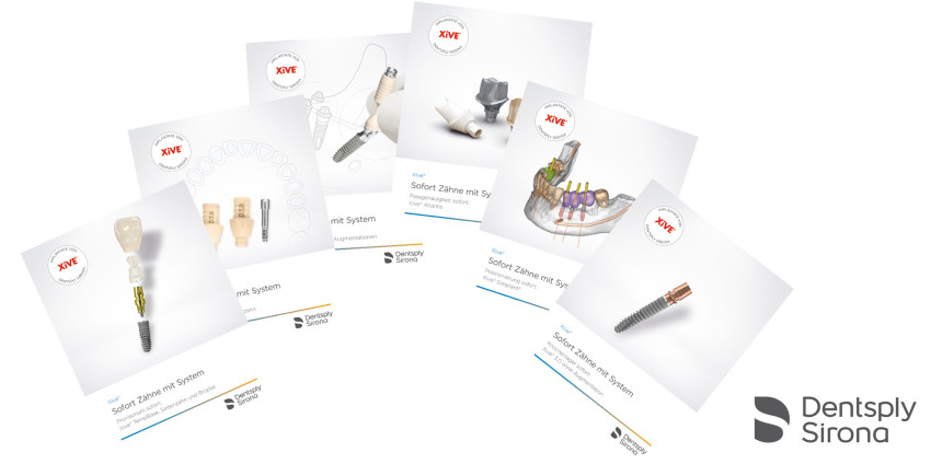 Smarte Sofortlösungen für die Praxis: Das Implantatsystem Xive – ZWP ...