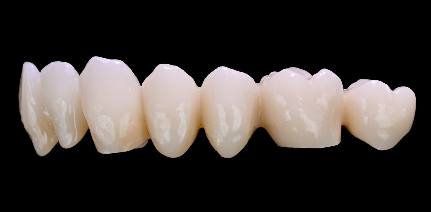 priti®multidisc: das neue Multitalent mit dem Plus an Transluzenz – ZWP ...