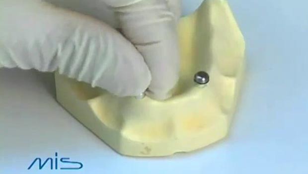 MIS Locator – ZWP online – das Nachrichtenportal für die Dentalbranche